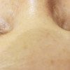 Eyelash Extension Gallery | Taylor Electrolysis & Cosmetic Accents