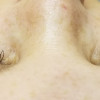Eyelash Extension Gallery | Taylor Electrolysis & Cosmetic Accents