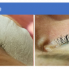 Eyelash Extension Gallery | Taylor Electrolysis & Cosmetic Accents