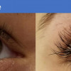 Eyelash Extension Gallery | Taylor Electrolysis & Cosmetic Accents